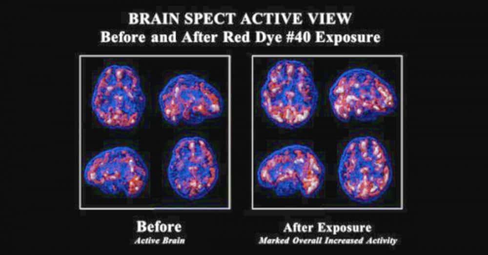Red Dye #40 Can Make Non-ADD Kids Hyperactive & Alter Brain Function