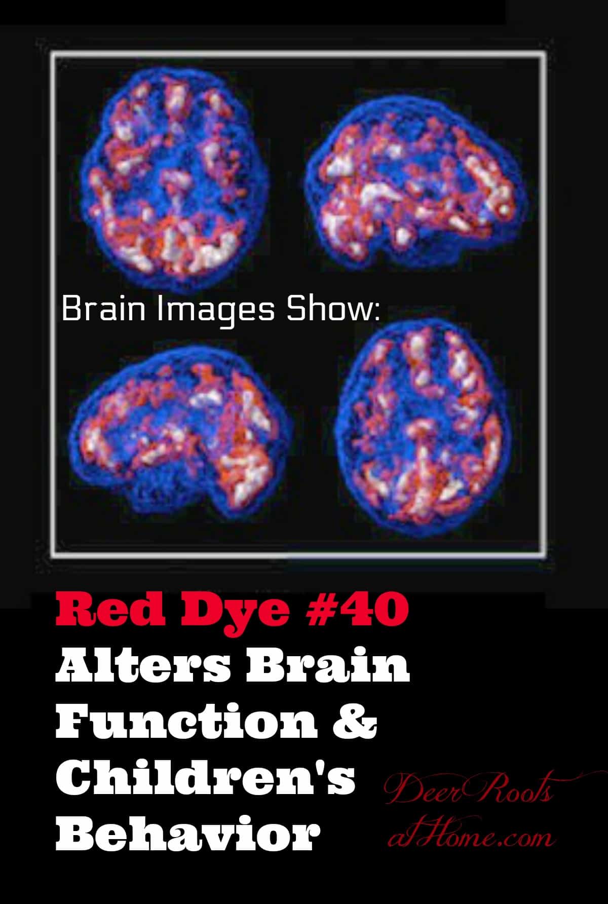 Red Dye #40 Can Make Non-ADD Kids Hyperactive & Alter Brain Function