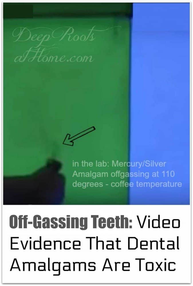 Off-Gassing Teeth: Video Evidence Dental Amalgams Are Toxic