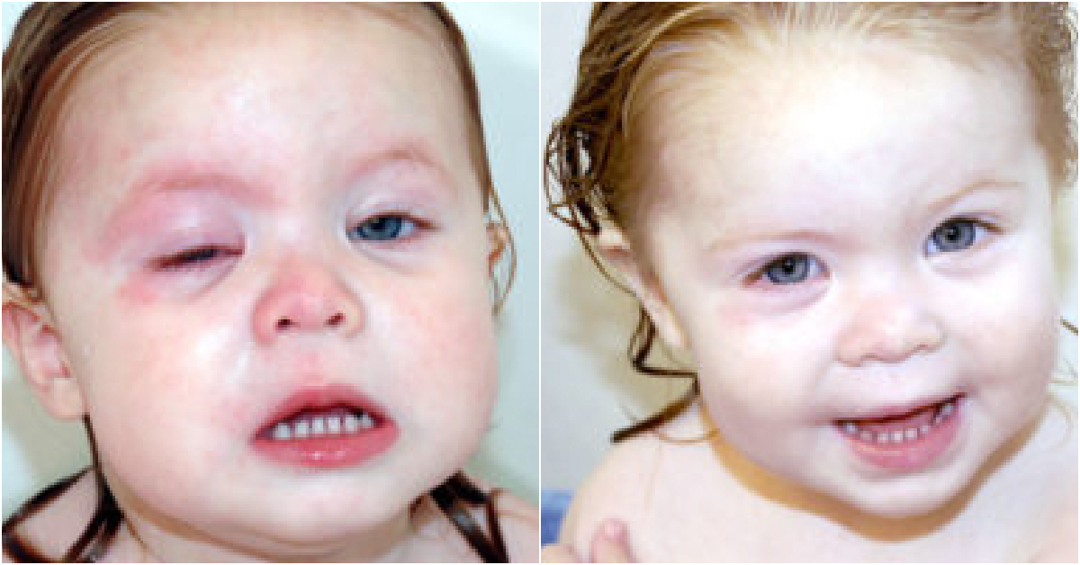 What Erica Did When Her Daughter Got Dish Soap In Her Eyes