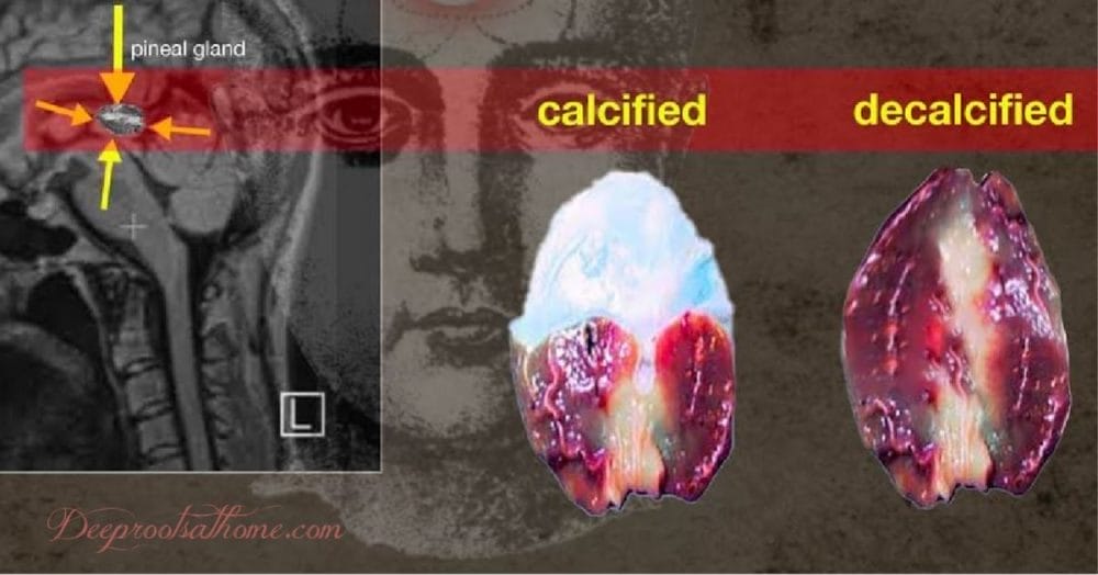 How To Decalcify the Pineal Gland & Also Undo the Damage
